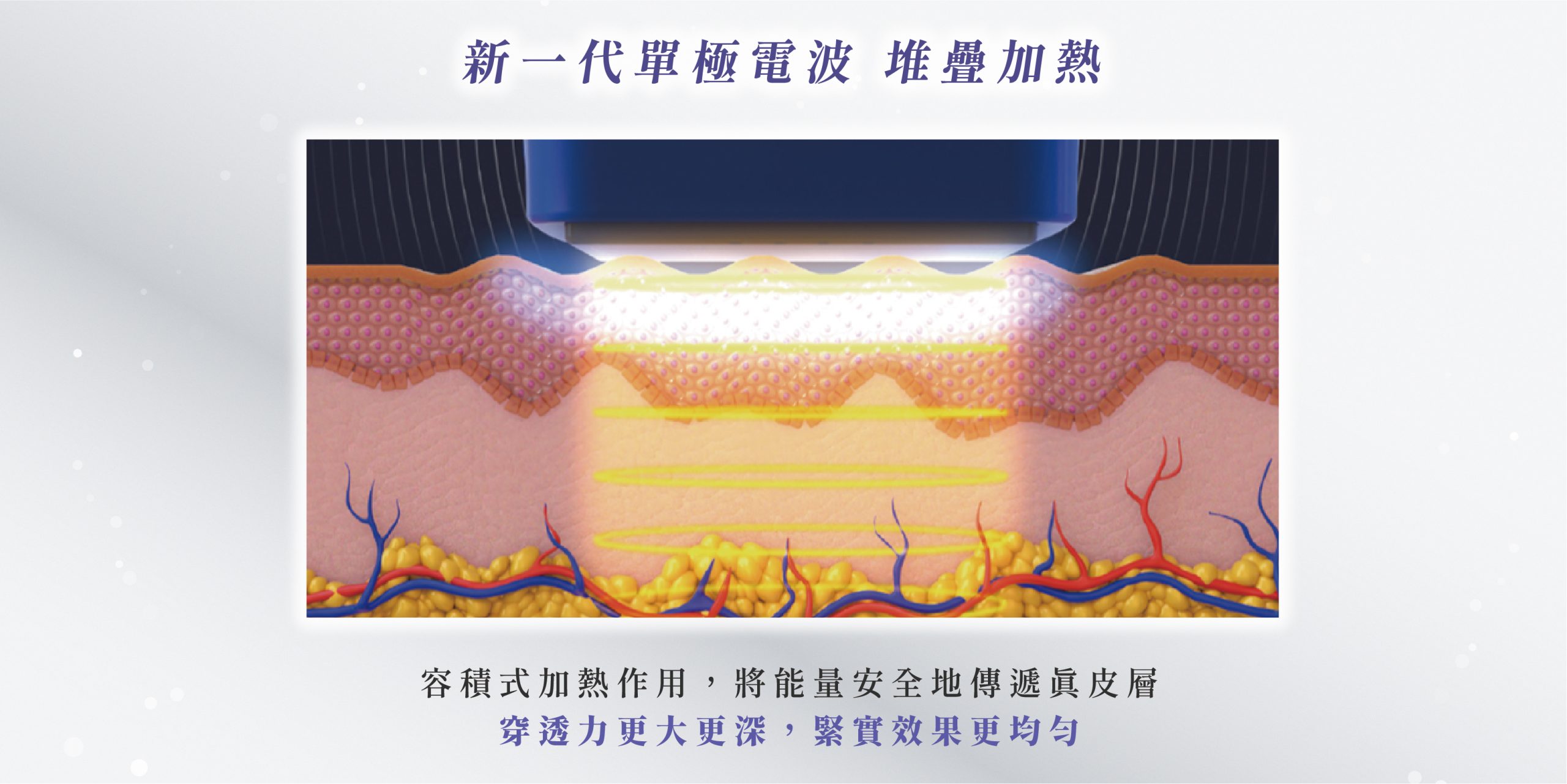 10 THERMA十倍電波｜辰星皮膚專科診所—大台北全方位抗老/醫美/微整治療 - 辰星皮膚專科診所