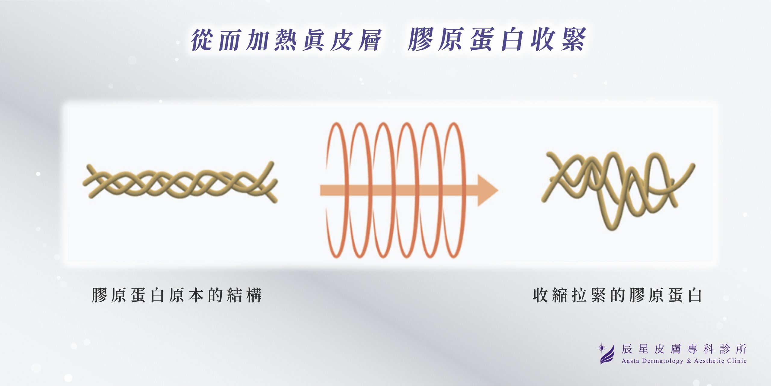 10 THERMA十倍電波｜辰星皮膚專科診所—大台北全方位抗老/醫美/微整治療 - 辰星皮膚專科診所