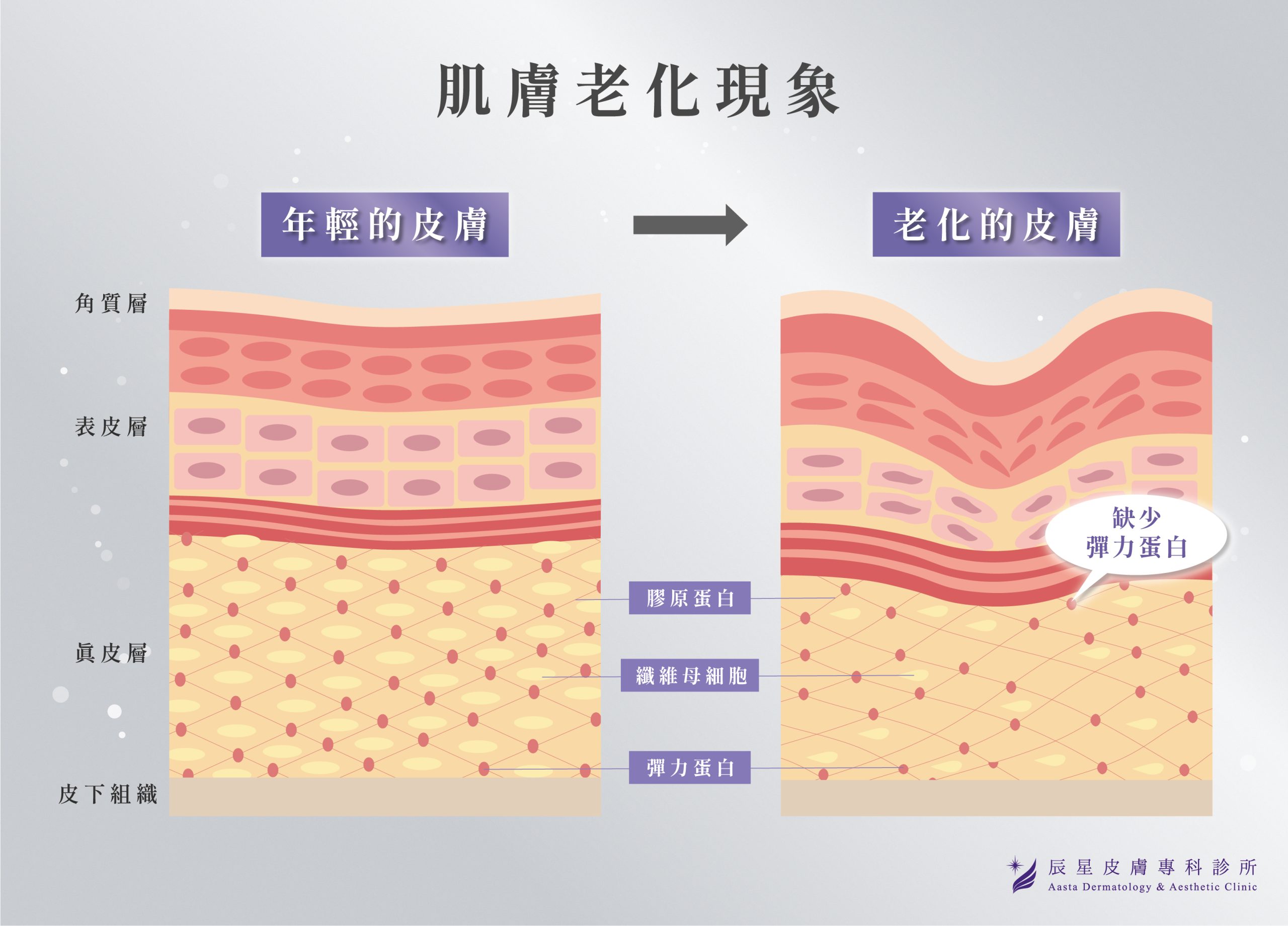 10 THERMA十倍電波｜辰星皮膚專科診所—大台北全方位抗老/醫美/微整治療 - 辰星皮膚專科診所